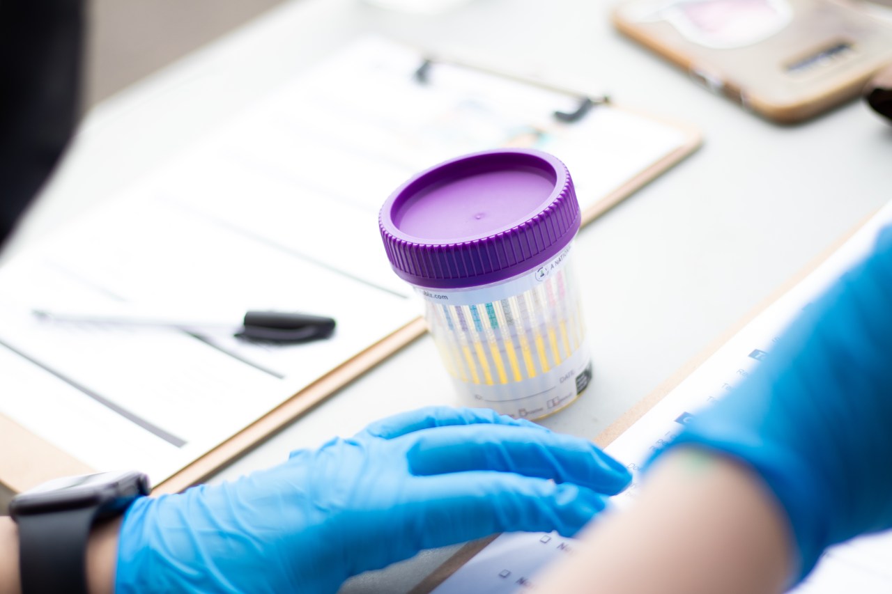 Urine Drug Testing in Oregon | Butterfield Testing Solutions